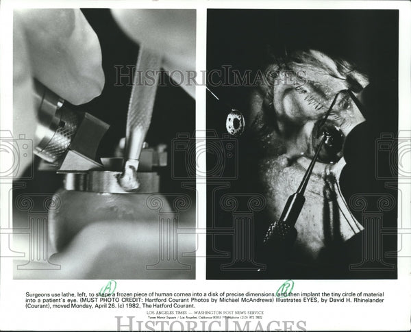 1982 Press Photo Surgeons shape frozen piece of cornea and implant into ...