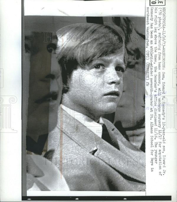 Sen Edward Kennedy's 12 Year Old Son Edward Jr Has Bone Cancer 1973 ...
