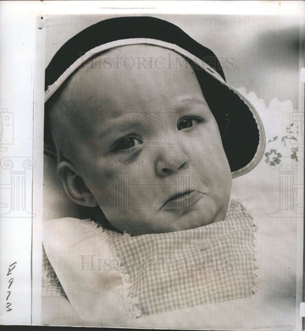 1963 Press Photo Chieanne Carr baby shiner black eye - Historic Images