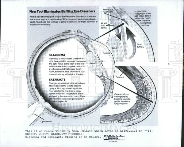1988 Press Photo human eye, laboratory - Historic Images