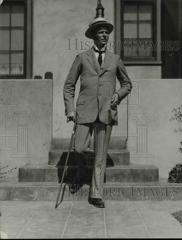 1925 Kay Jorgensen, Man with Partial Leg Missing - Historic Images