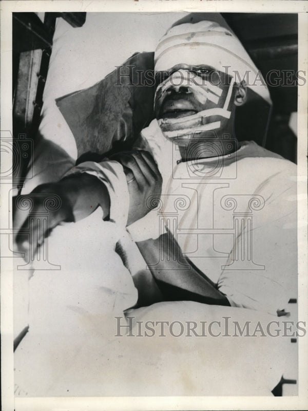 1938 Press Photo Tommy Rhodes in general hospital after police claim h ...