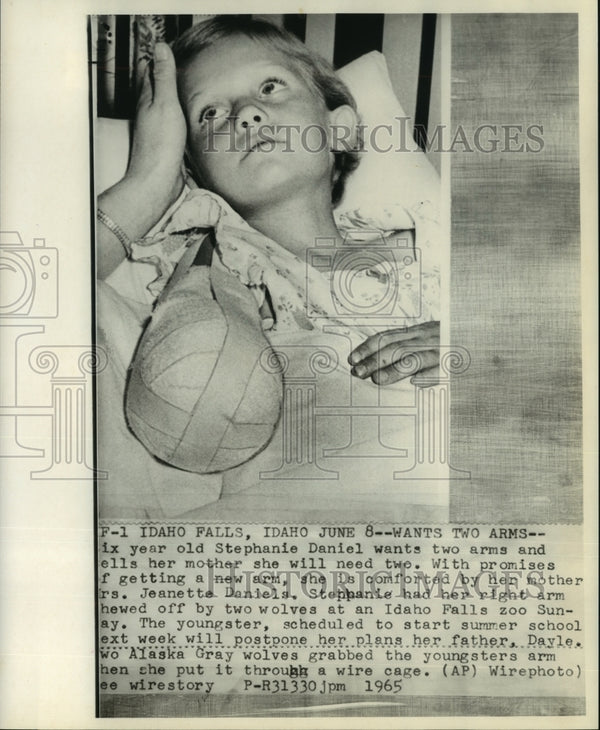 1965 Stephanie Daniel in hospital after arm chewed off by zoo wolves ...